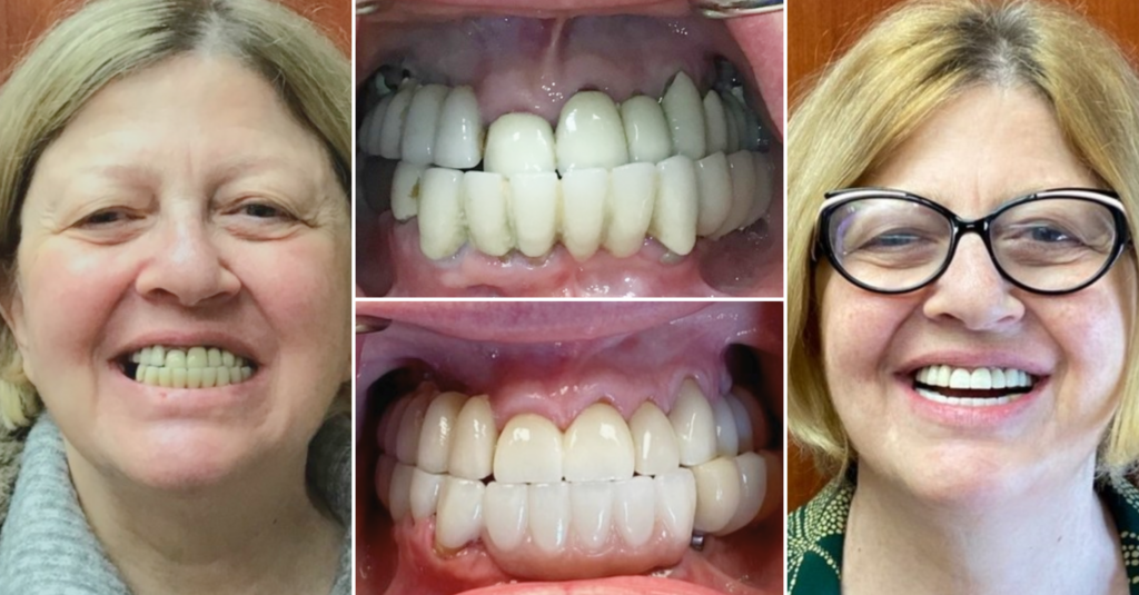 Premier Dental Associates | Best Dentist in Lyndhurst OH